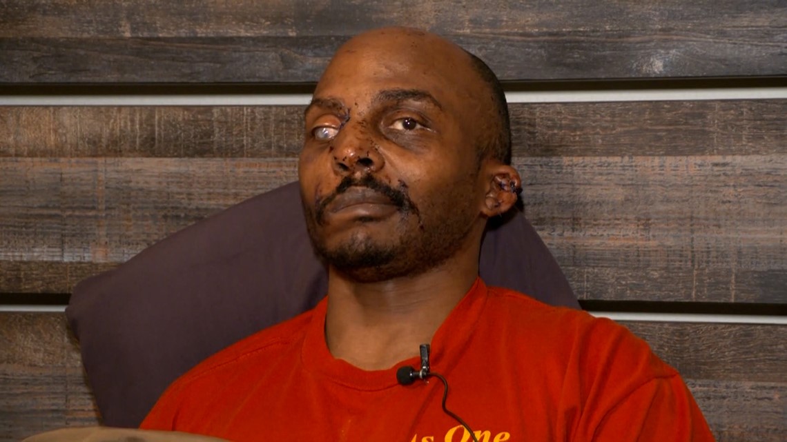 Arlington, Texas dog attack: Eric Moten arrested | wfmynews2.com