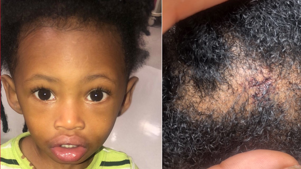 High Point toddler grazed by bullet after shots fired into home ...