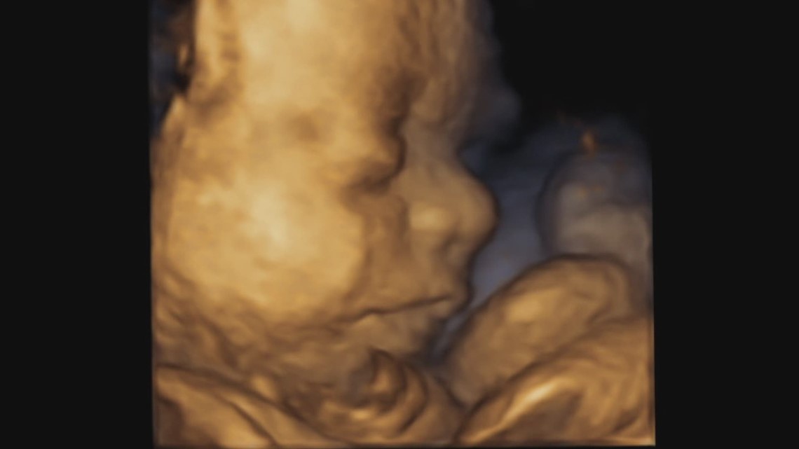 Baby Born With Intestines Outside Of Body | wfmynews2.com