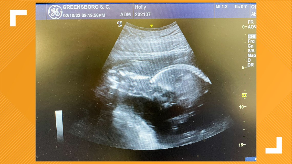 Holly the hippo is pregnant at the Greensboro Science Center ...