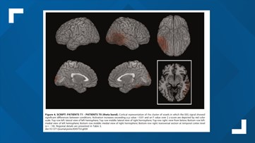 What is EMDR therapy and does it work? | wfmynews2.com