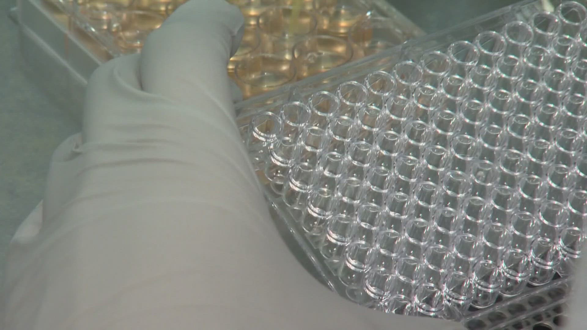 Expert explains TB and TB history | wfmynews2.com