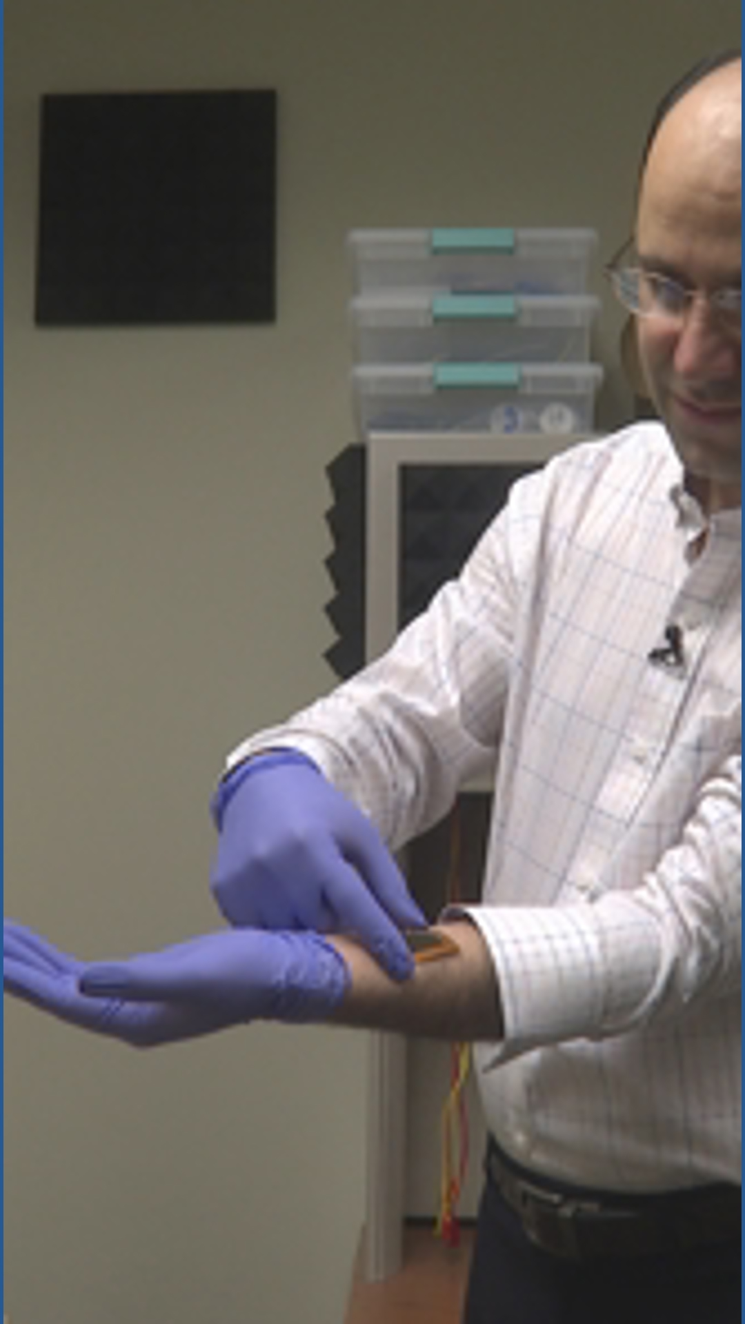 WFU researchers develop wearable patch for early skin cancer detection ...