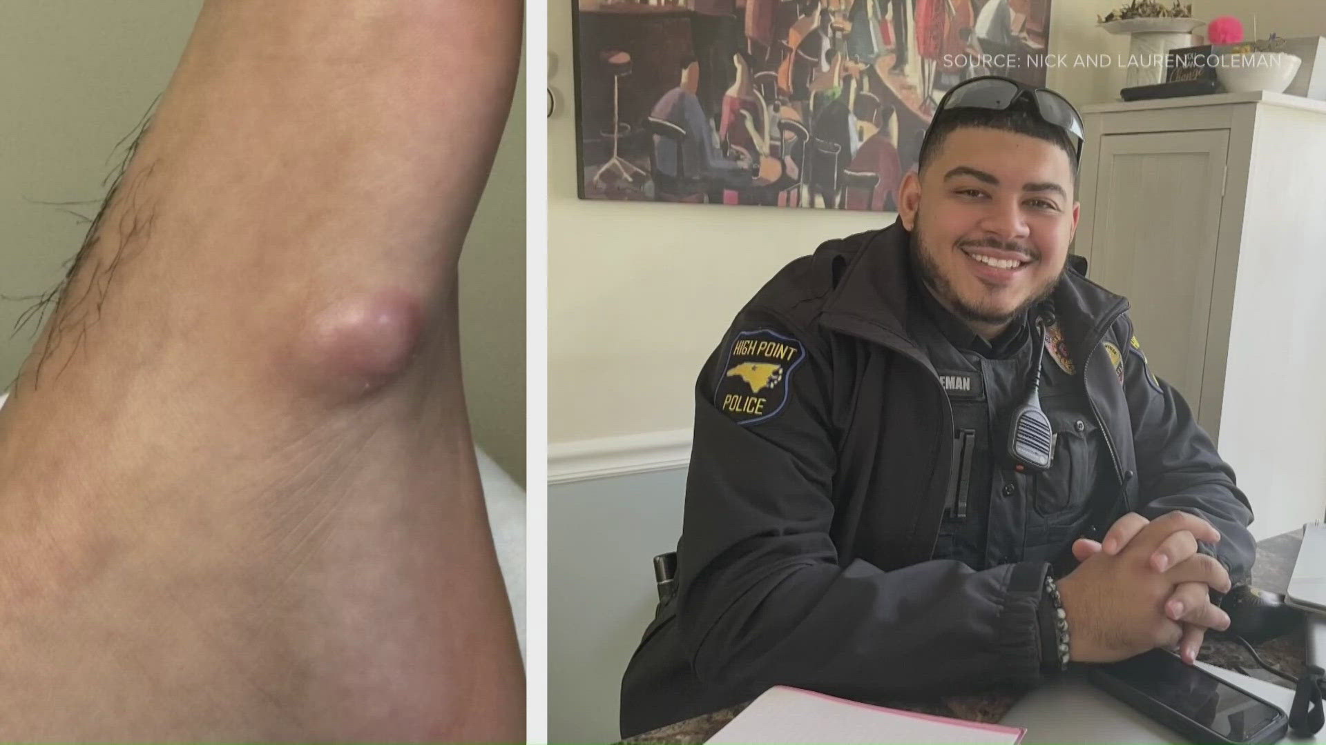 High Point police officer beats rare bone cancer, returns to work after ...