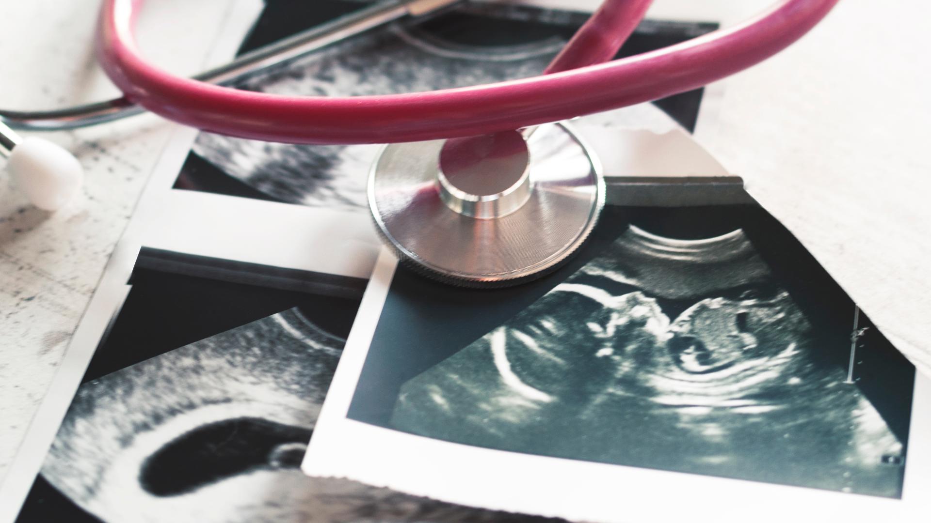 $5,000 Baby Bonus? Here's what's really happening | wfmynews2.com