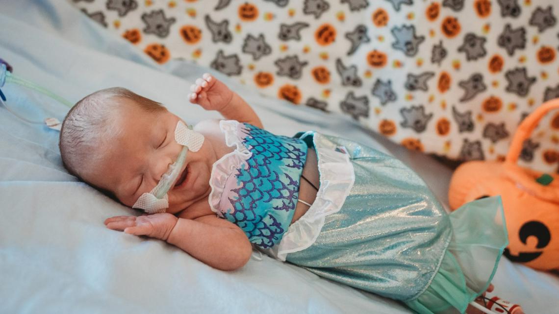 Brenner Children's Hospital NICU babies dress up for Halloween ...