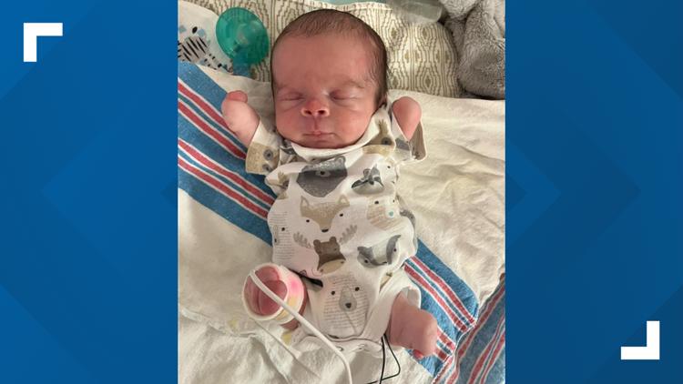 North Carolina baby born without arms or legs is defying the odds ...