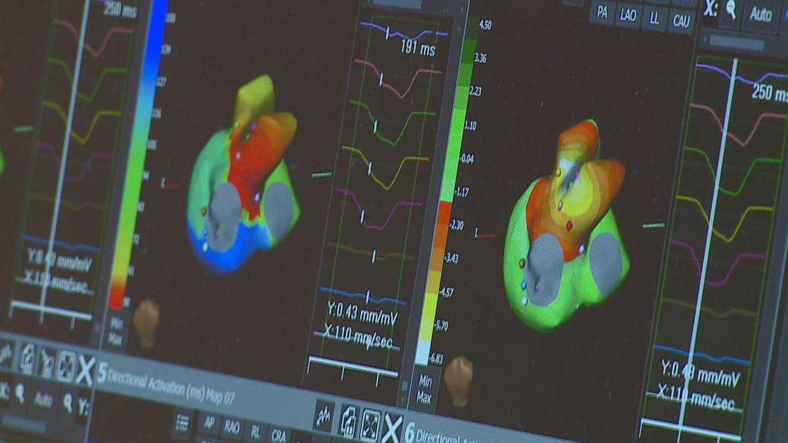 Novant Health technology shortens heart procedure | wfmynews2.com