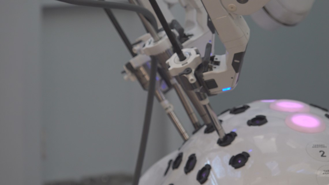 Medical Robot is changing the way doctors perform surgeries | wfmynews2.com
