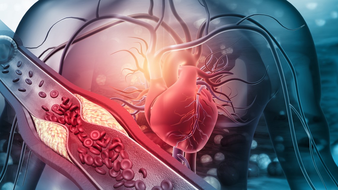 What is cholesterol and how does it affect your heart? | wfmynews2.com